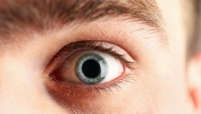 Vendrais-tu tes yeux pour 1 milliard d’euros ? - Français Authentique